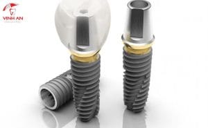 Trụ Implant Dentium: Ưu Nhược Điểm, Giá Cả, Xuất Xứ