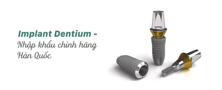 Trụ Implant Dentium: Ưu Nhược Điểm, Giá Cả, Xuất Xứ