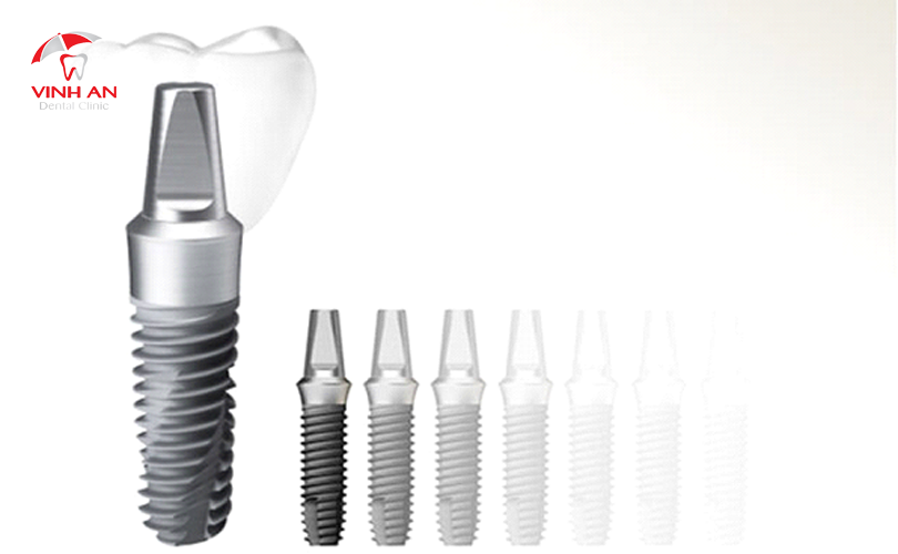 Trụ Implant Sic Có Cấu Tạo và Xuất Xứ Từ Đâu? Ưu Điểm Và Gía Cả